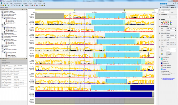 Review Philips Actiwatch 2: Jam Tangan Aktigrafi Untuk Memonitor ...